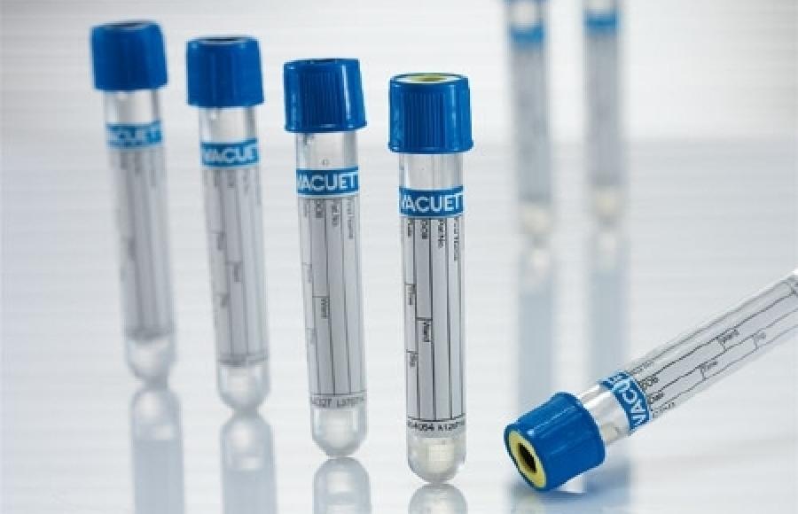 Greiner Bio-One VACUETTE Venous Blood Collection Tubes, Pull Cap, 13 X ...